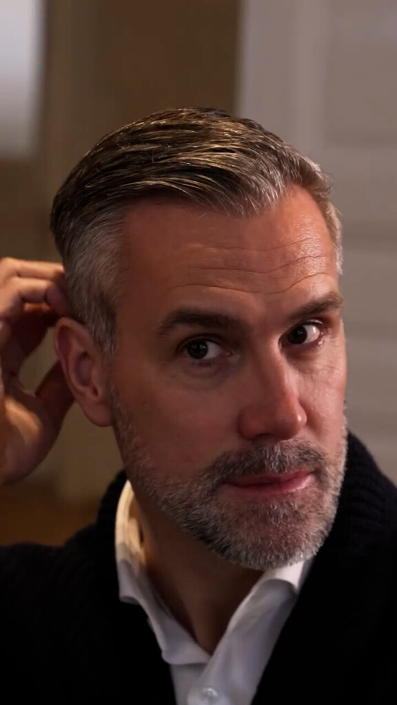 Haartransplantation von Stefan Maierhofer | Moser Medical